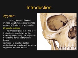 Zygomatic Maxillary Buttress