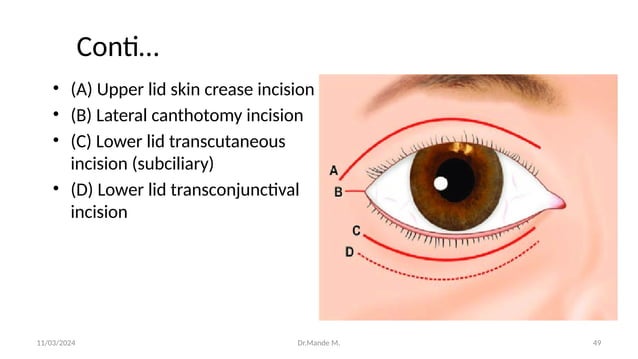 Zygomaticomaxillary complex Fracture pptx | PPT