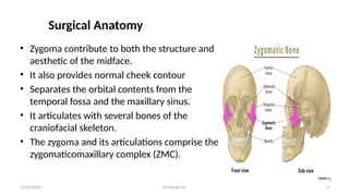 Zygomaticomaxillary complex Fracture pptx | PPTX