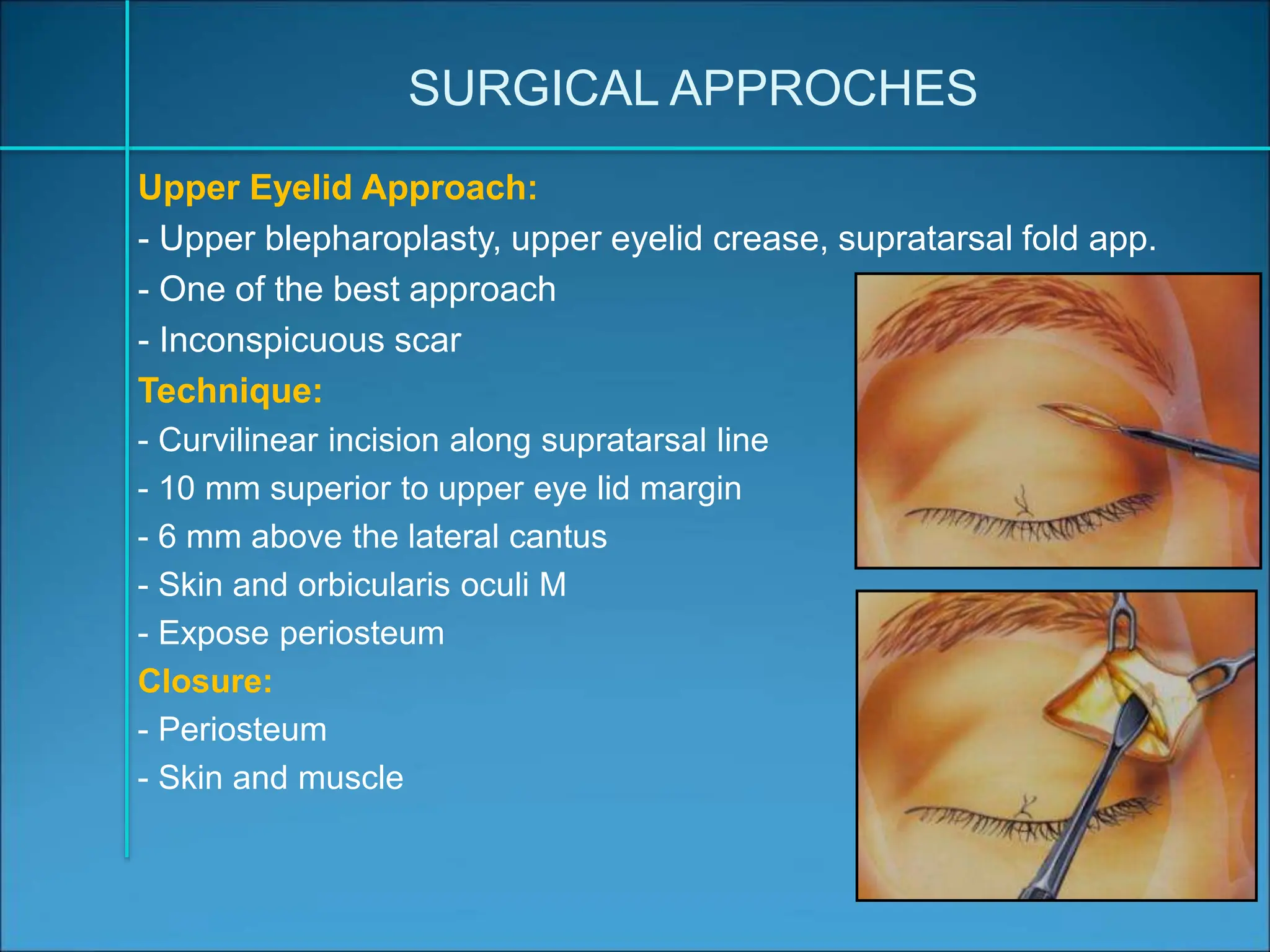 ZMC Fractures - Copy.ppt zygomatico maxillary fracture | PPT