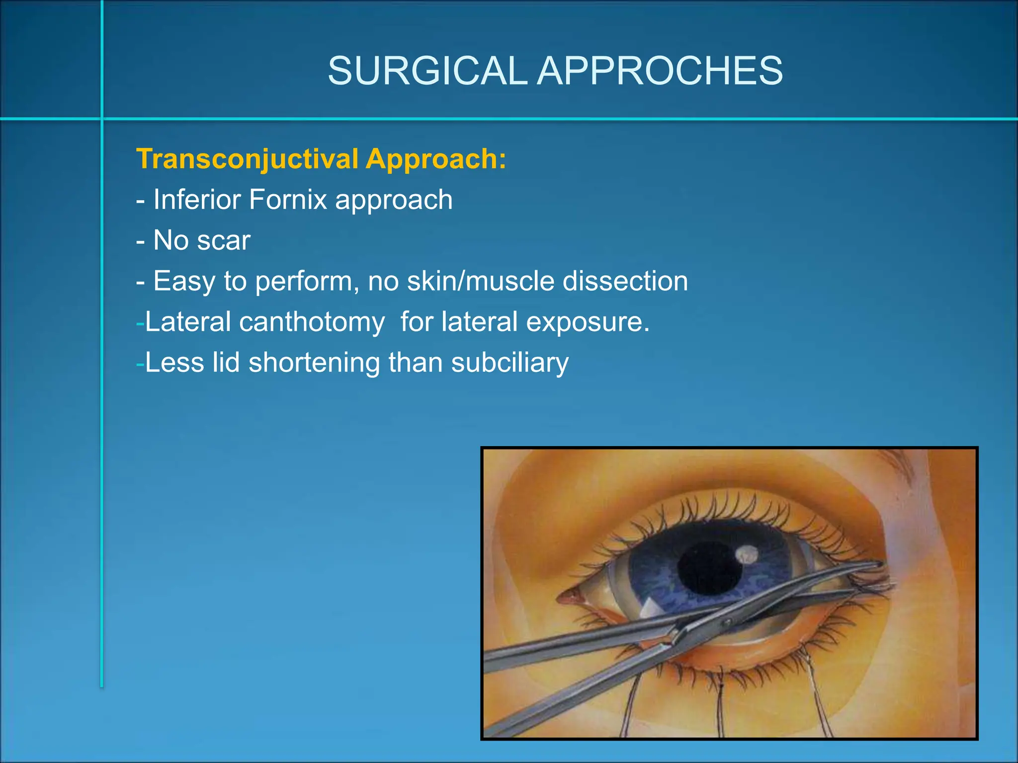 ZMC Fractures - Copy.ppt zygomatico maxillary fracture | PPT