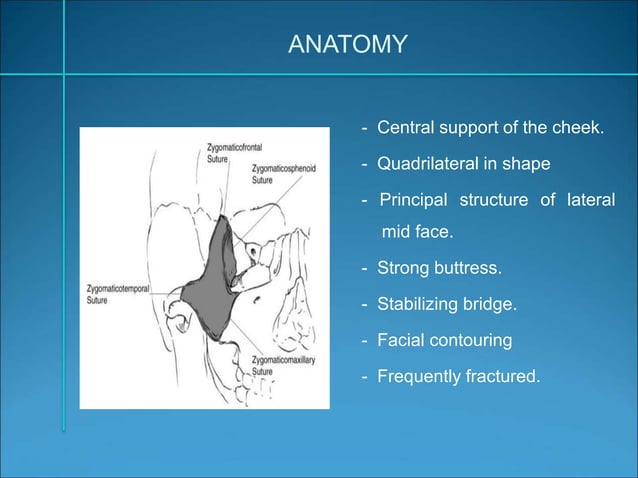ZMC Fractures - Copy.ppt zygomatico maxillary fracture | PPT