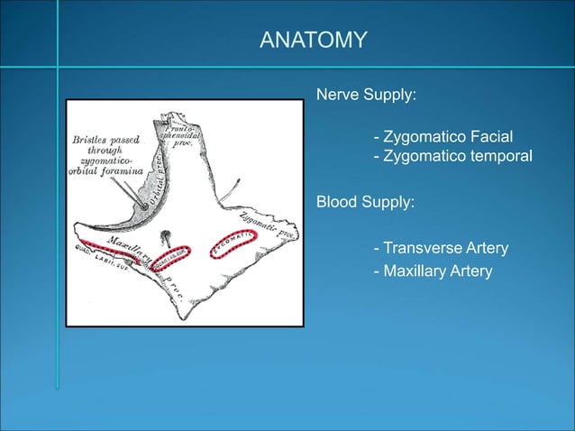 ZMC Fractures - Copy.ppt zygomatico maxillary fracture | PPT