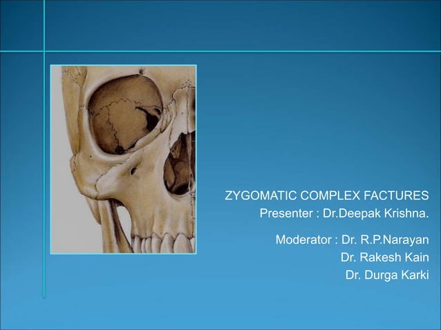 ZMC Fractures - Copy.ppt zygomatico maxillary fracture | PPT