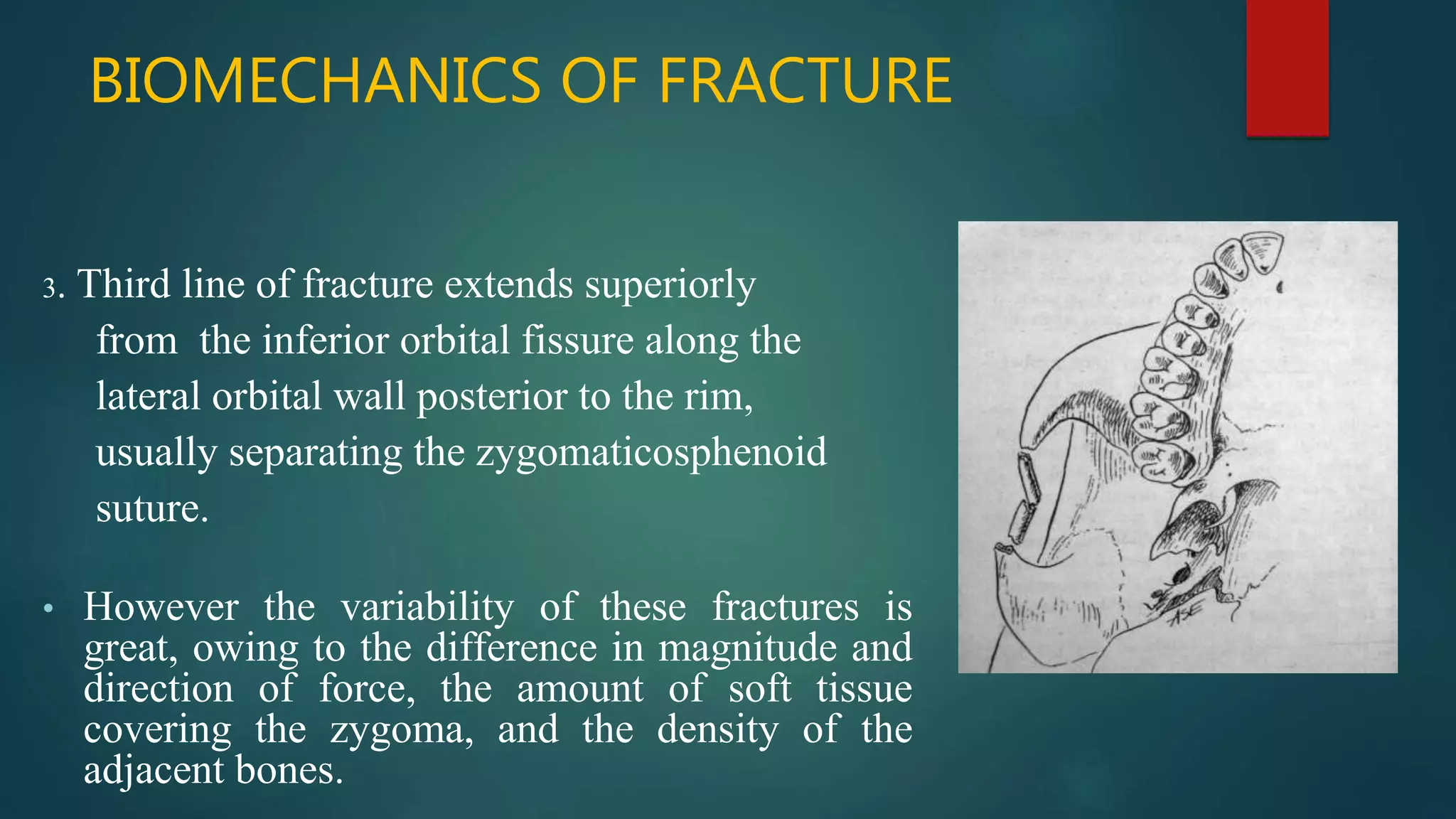 Zmc fractures part 1 | PPTX