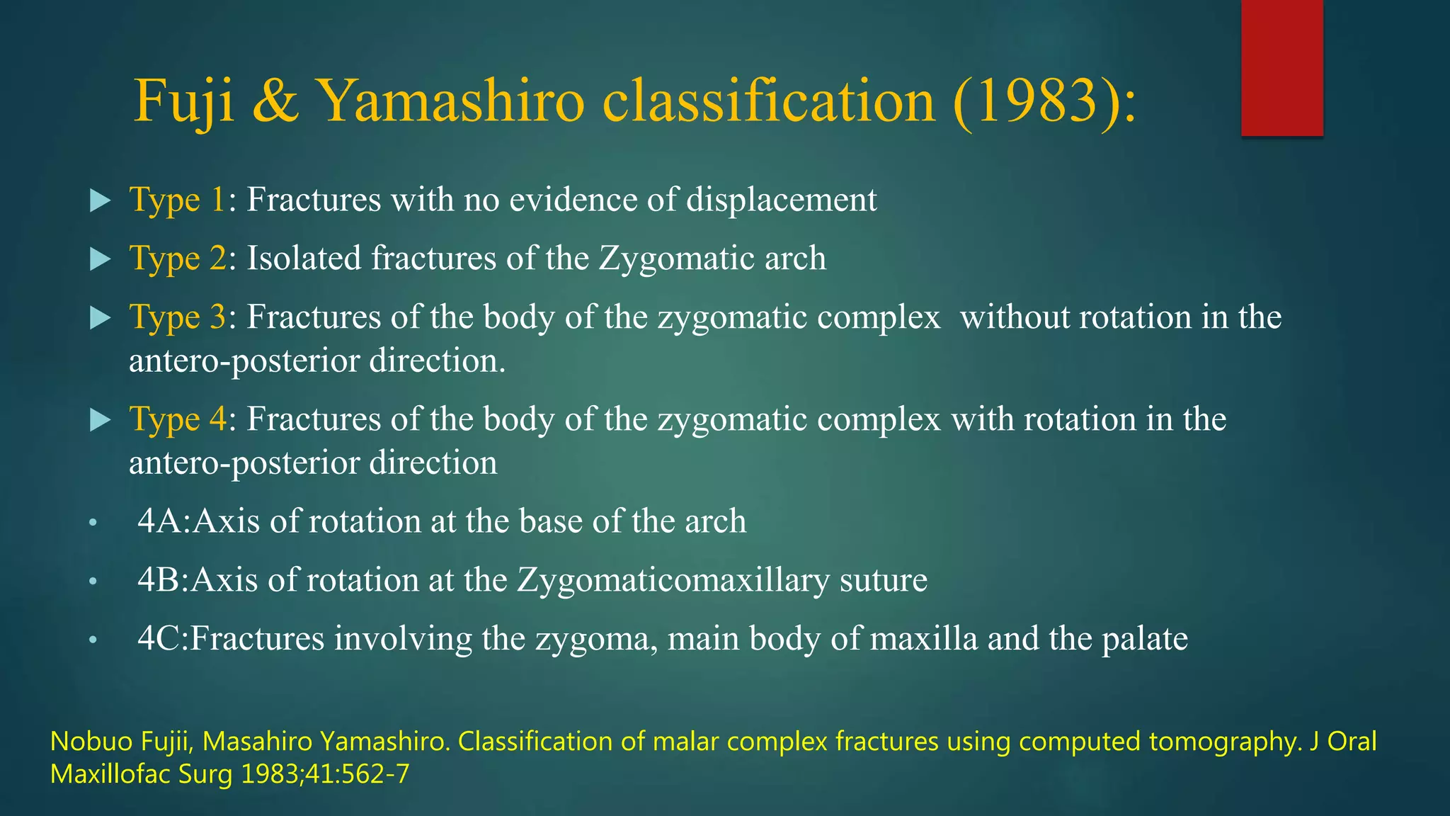 Zmc fractures part 1 | PPTX
