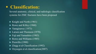 Zmc fractures part 1 | PPTX