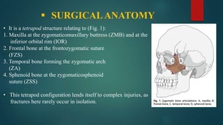 Zmc fractures part 1 | PPTX