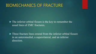 Zmc fractures part 1 | PPTX