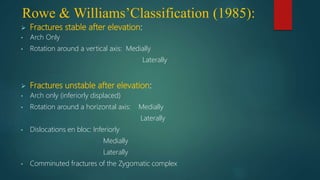 Zmc fractures part 1 | PPT
