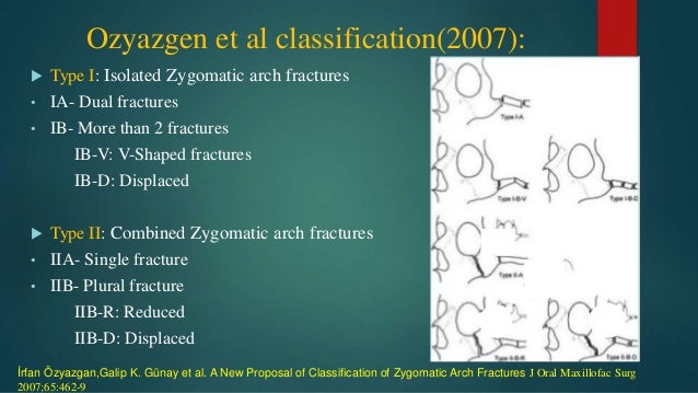 Zmc fractures part 1