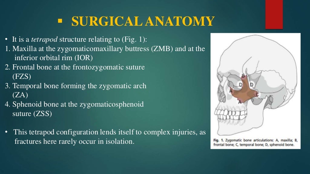 Zmc fractures part 1