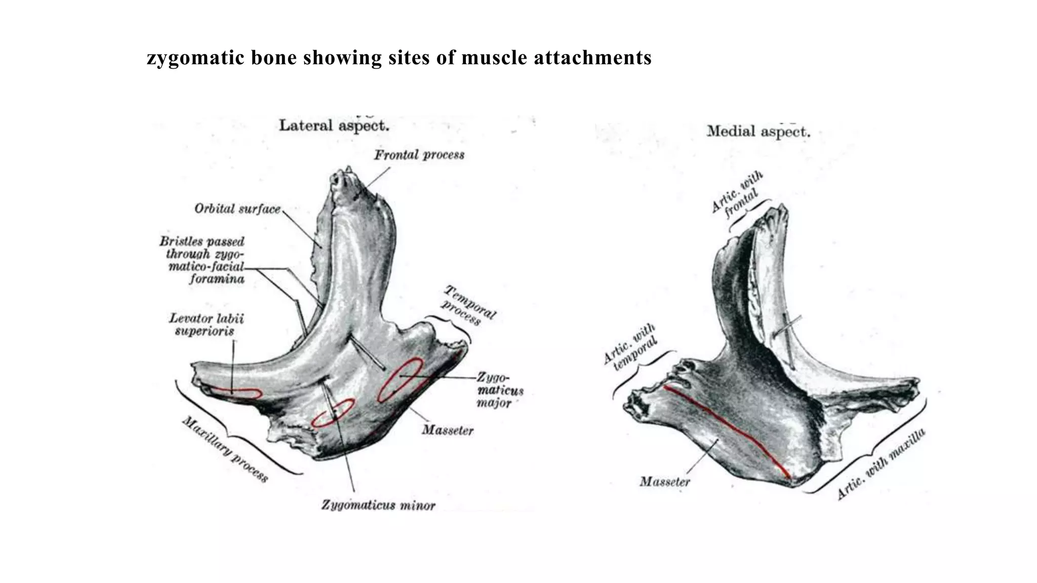 Zmc fractures and management | PPTX