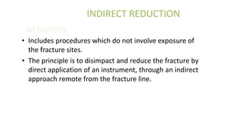 Zmc fractures and management | PPTX