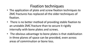 Zmc fractures and management | PPTX