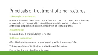 ZMC Fracture | PPT