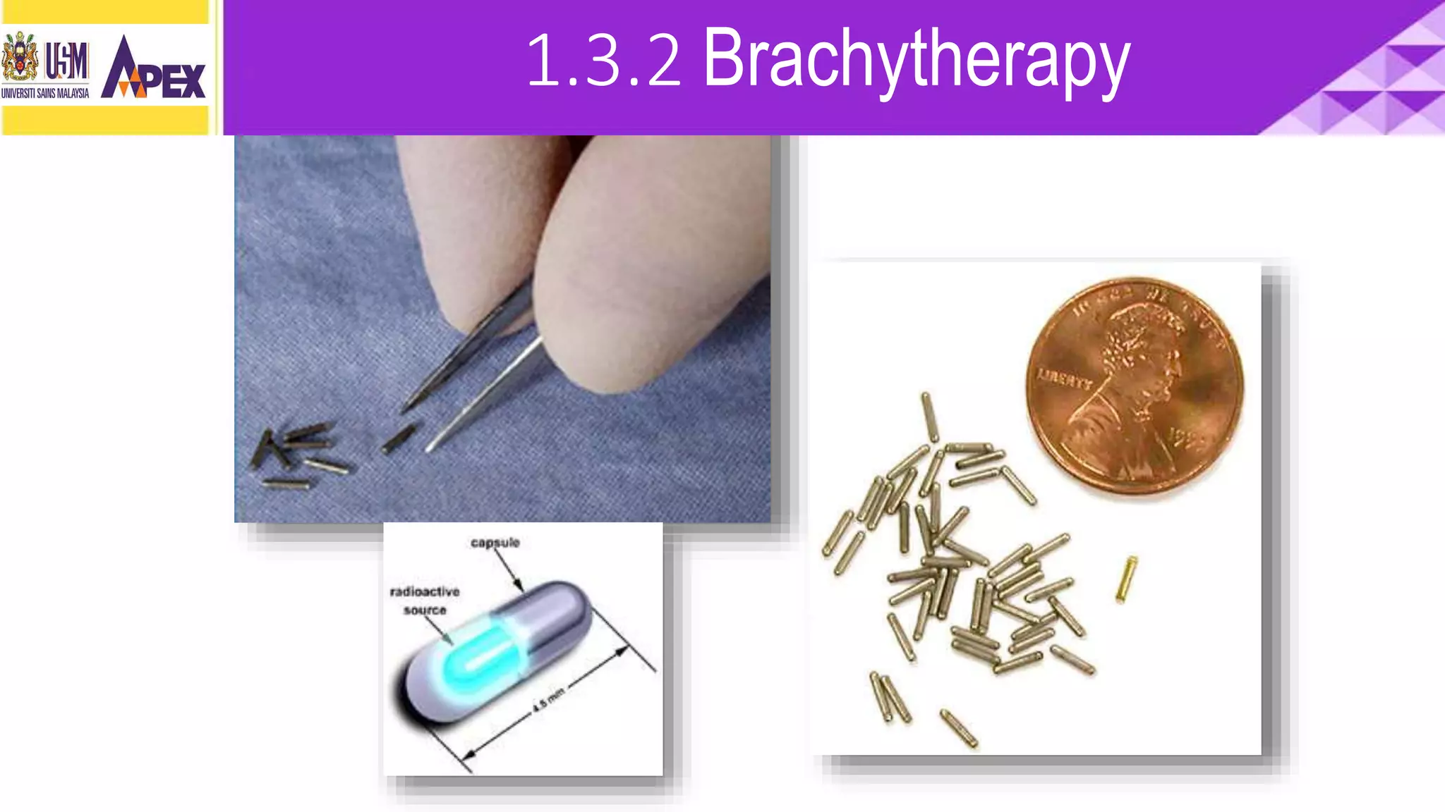 introduction of Radiotherapy | PPTX