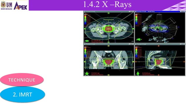 introduction of Radiotherapy | PPTX