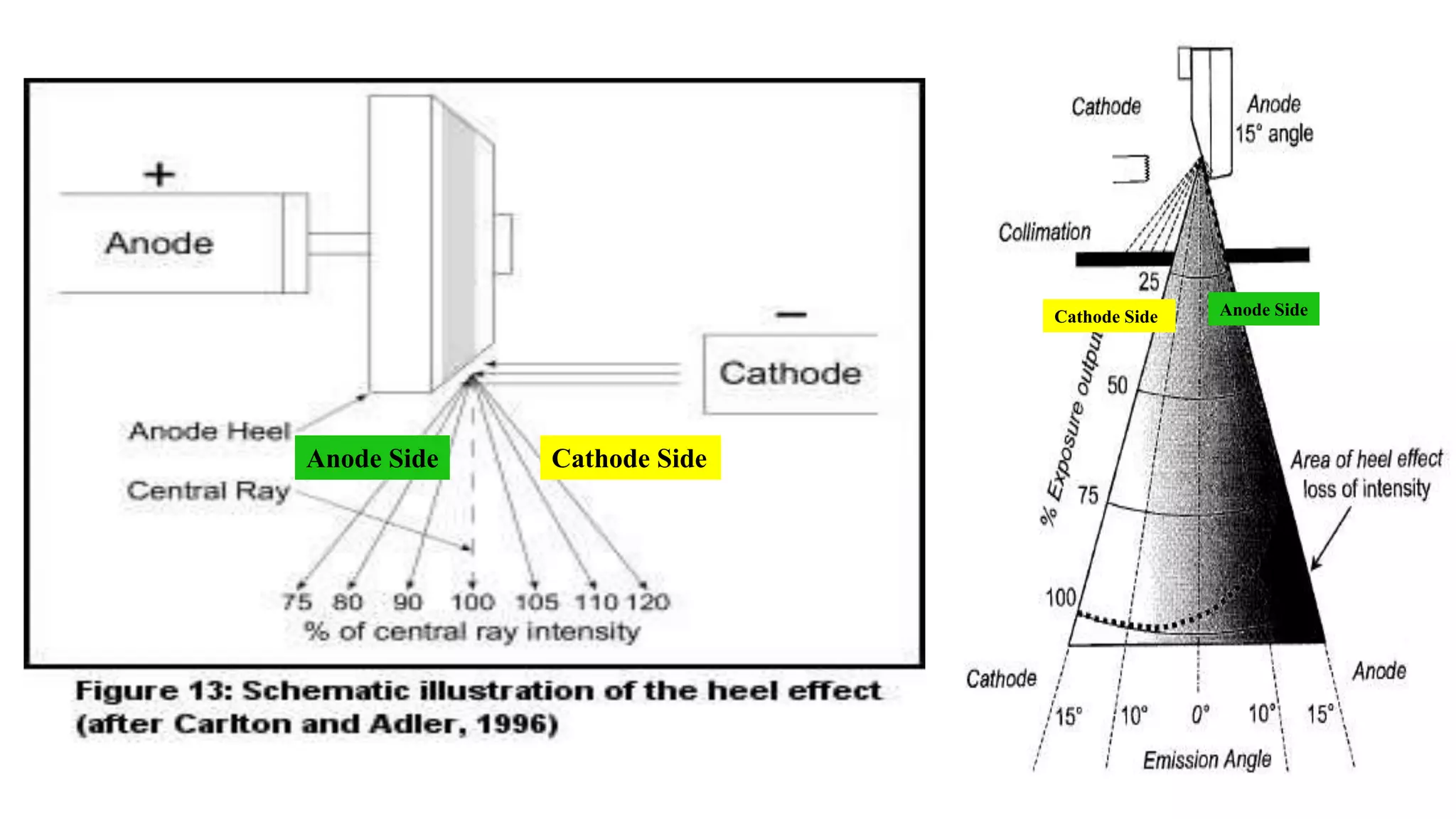 X-RAY TUBE (ANODE) | PPTX