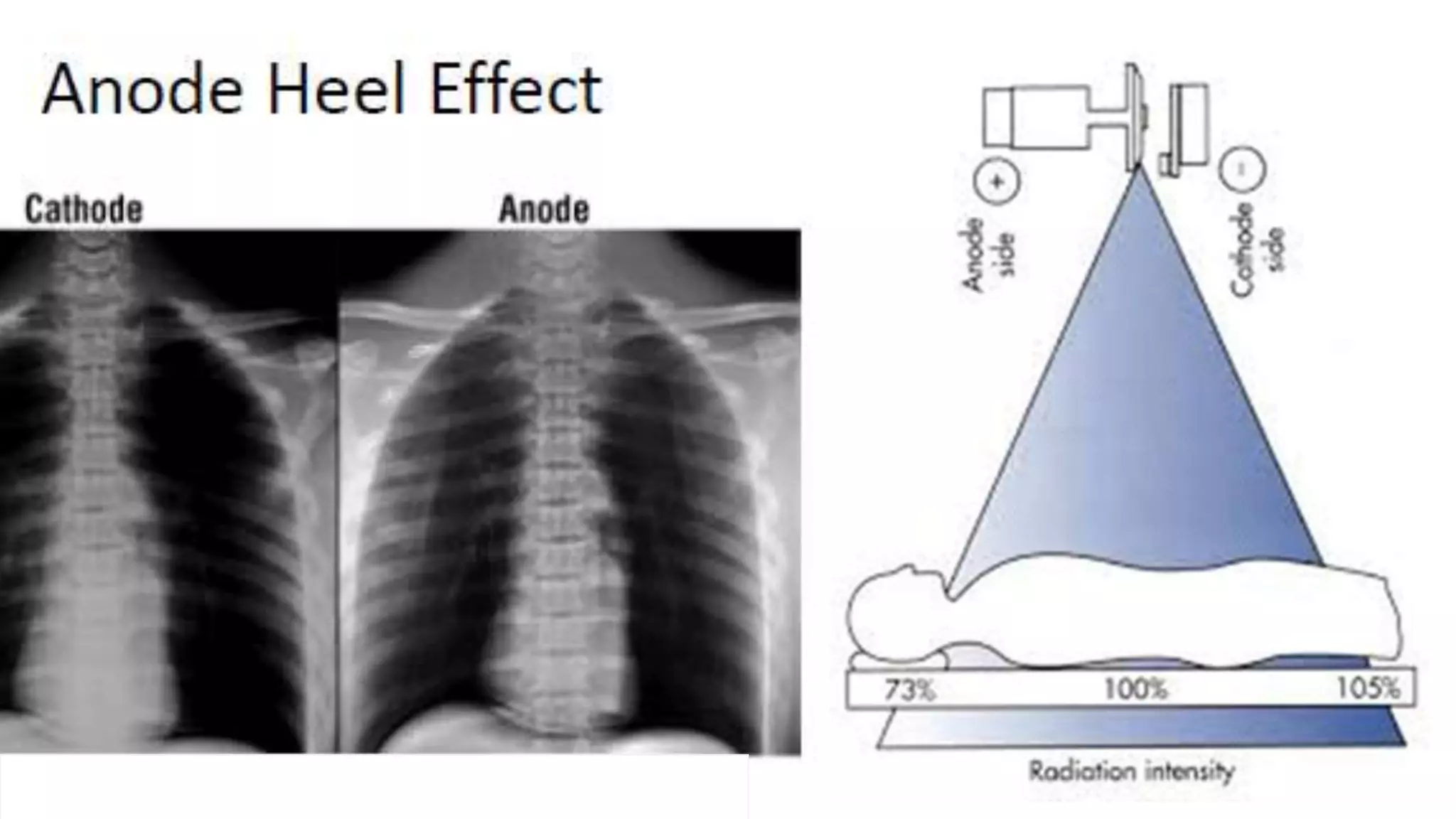 X-RAY TUBE (ANODE) | PPTX