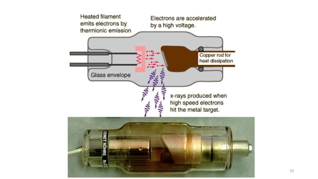 X-RAY TUBE (ANODE) | PPTX