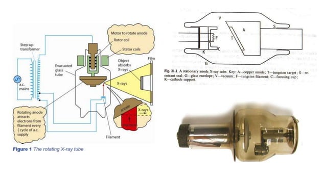 X-RAY TUBE (ANODE) | PPTX