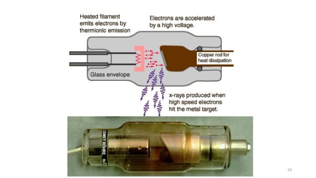 X-RAY TUBE (ANODE)