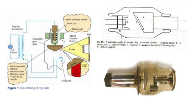 X-RAY TUBE (ANODE)