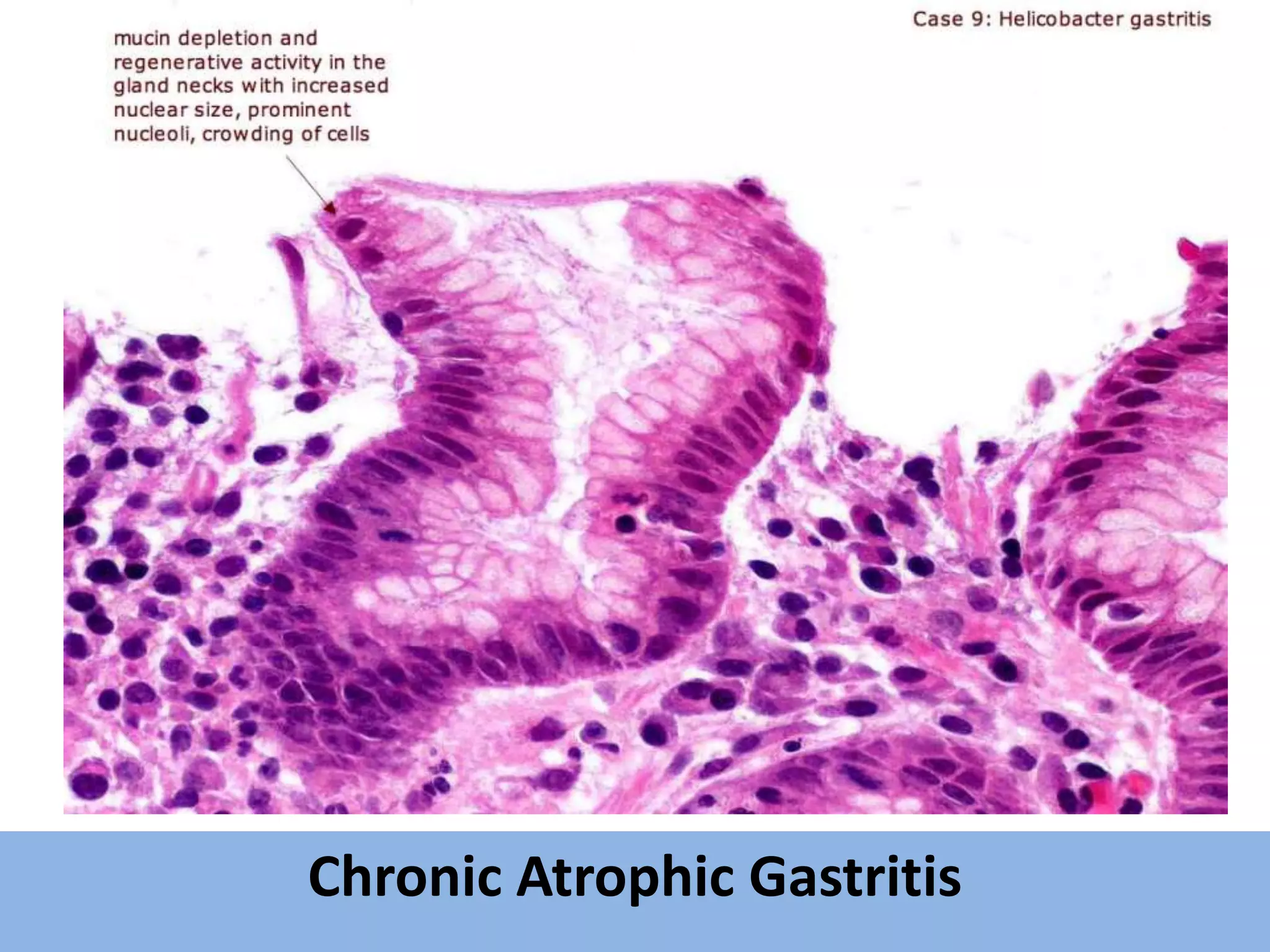Histological features of gastrointestinal tract with clinical ...