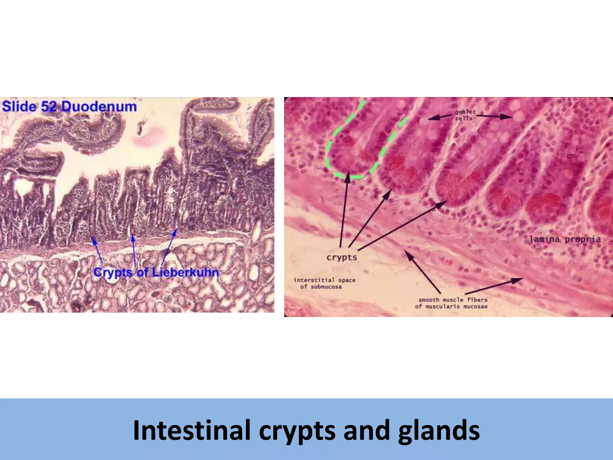 Histological features of gastrointestinal tract with clinical ...