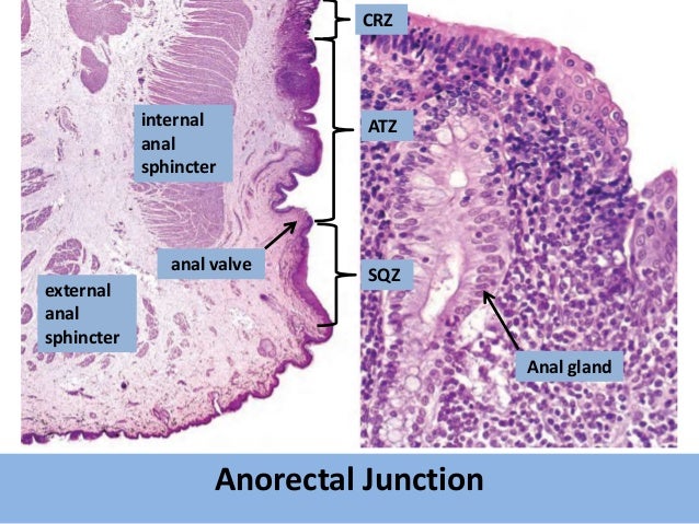 Rectoanal Junction Histology