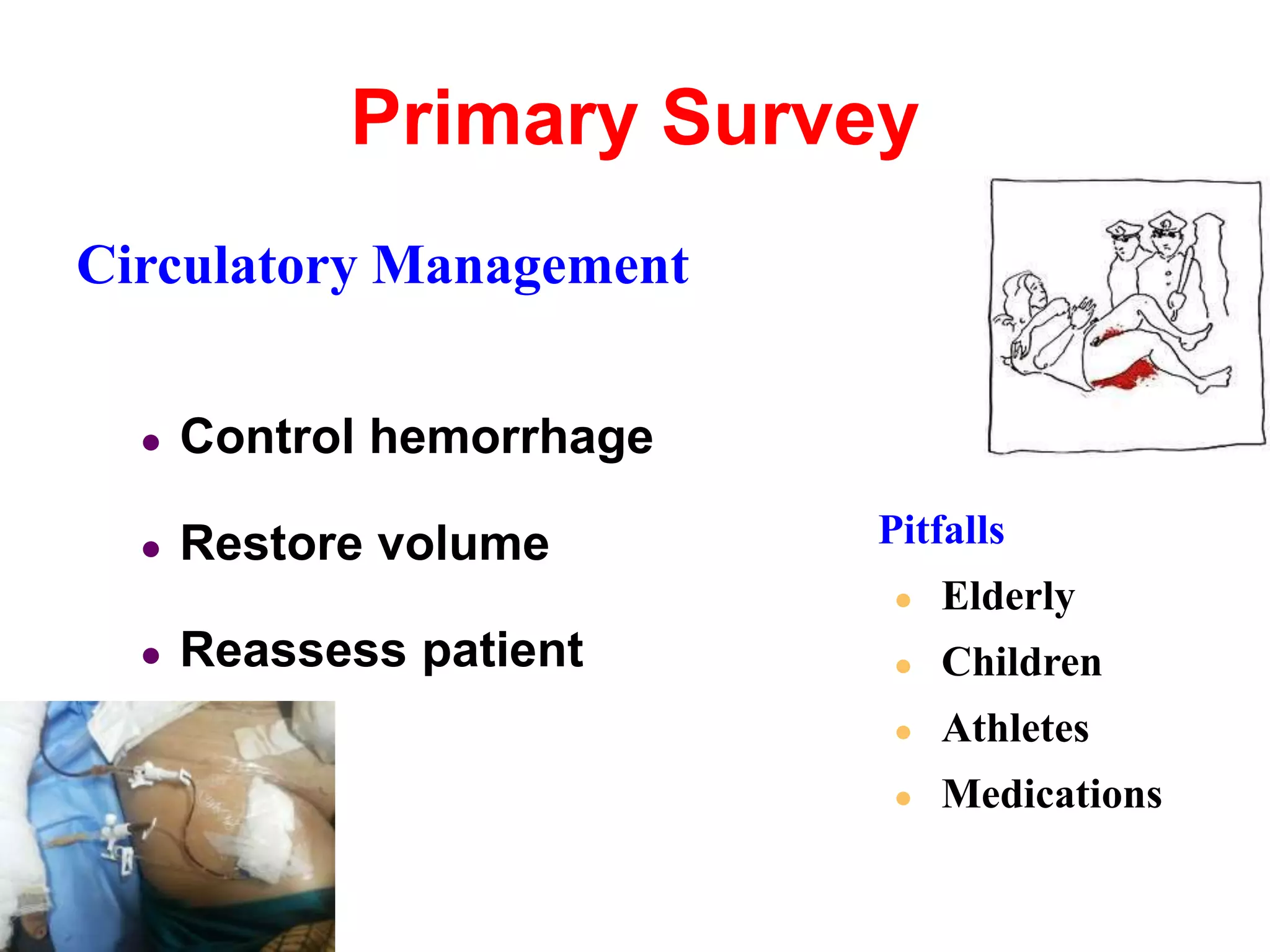 Primary survey in Trauma | PPTX
