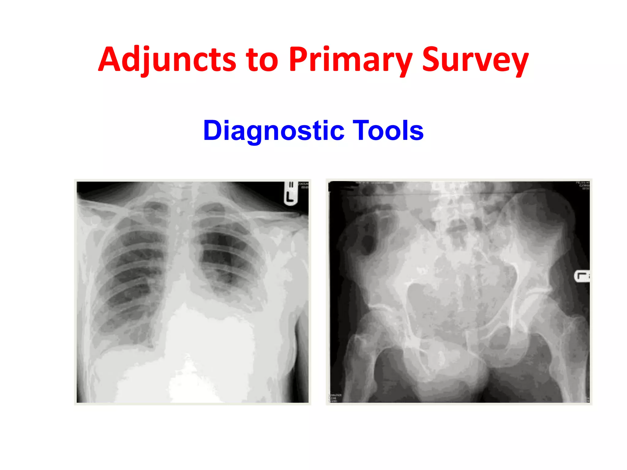 Primary survey in Trauma | PPTX