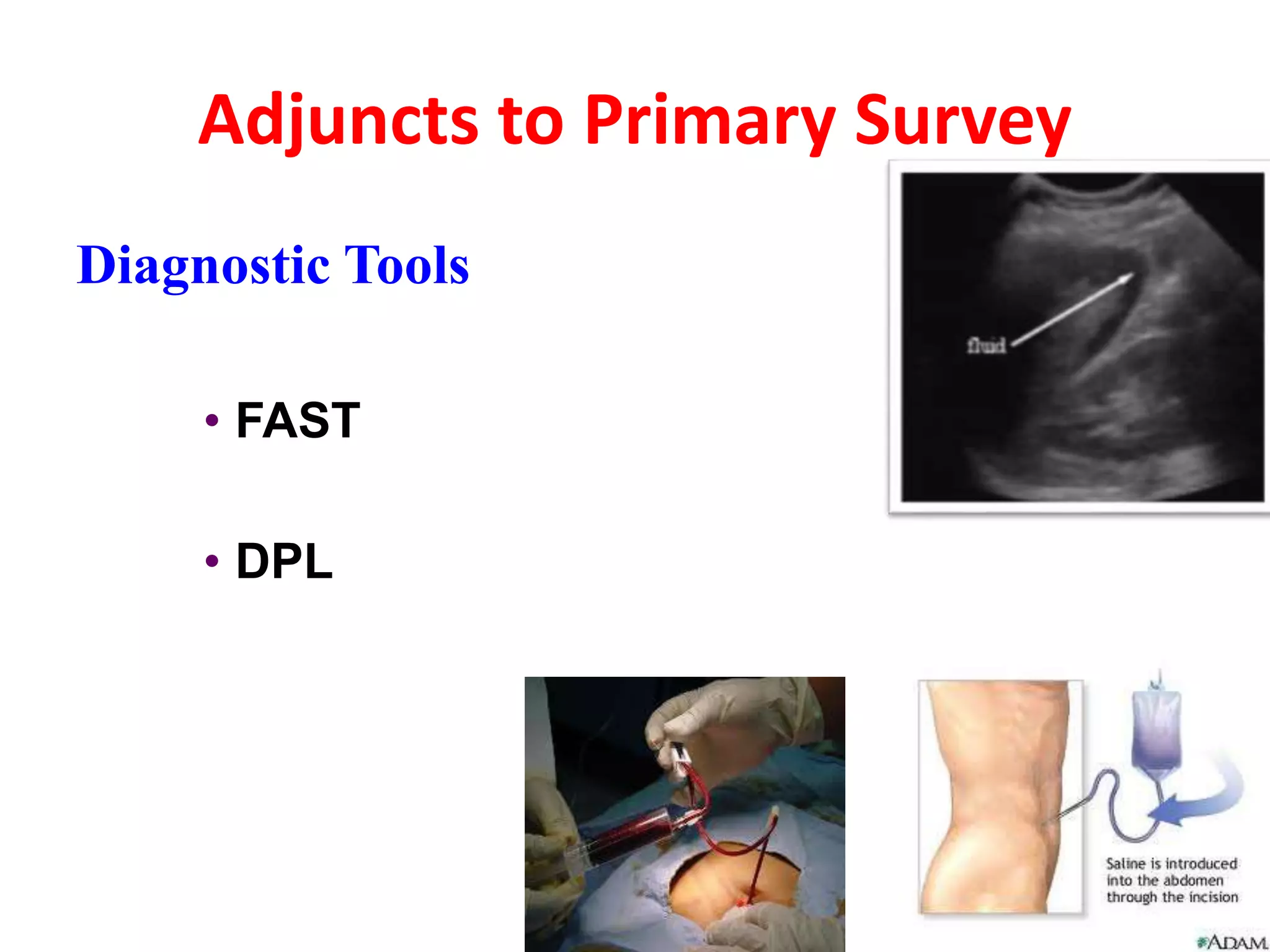 Primary survey in Trauma | PPTX