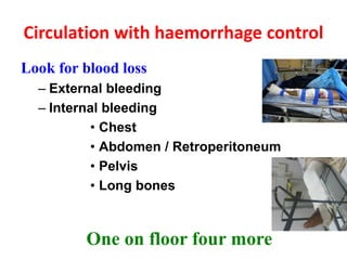 Primary survey in Trauma | PPTX