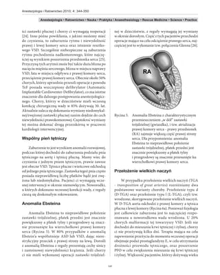 Znieczulenie doroslego pacjenta z wada serca | PDF