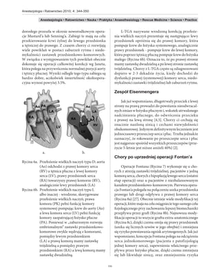 Znieczulenie doroslego pacjenta z wada serca | PDF