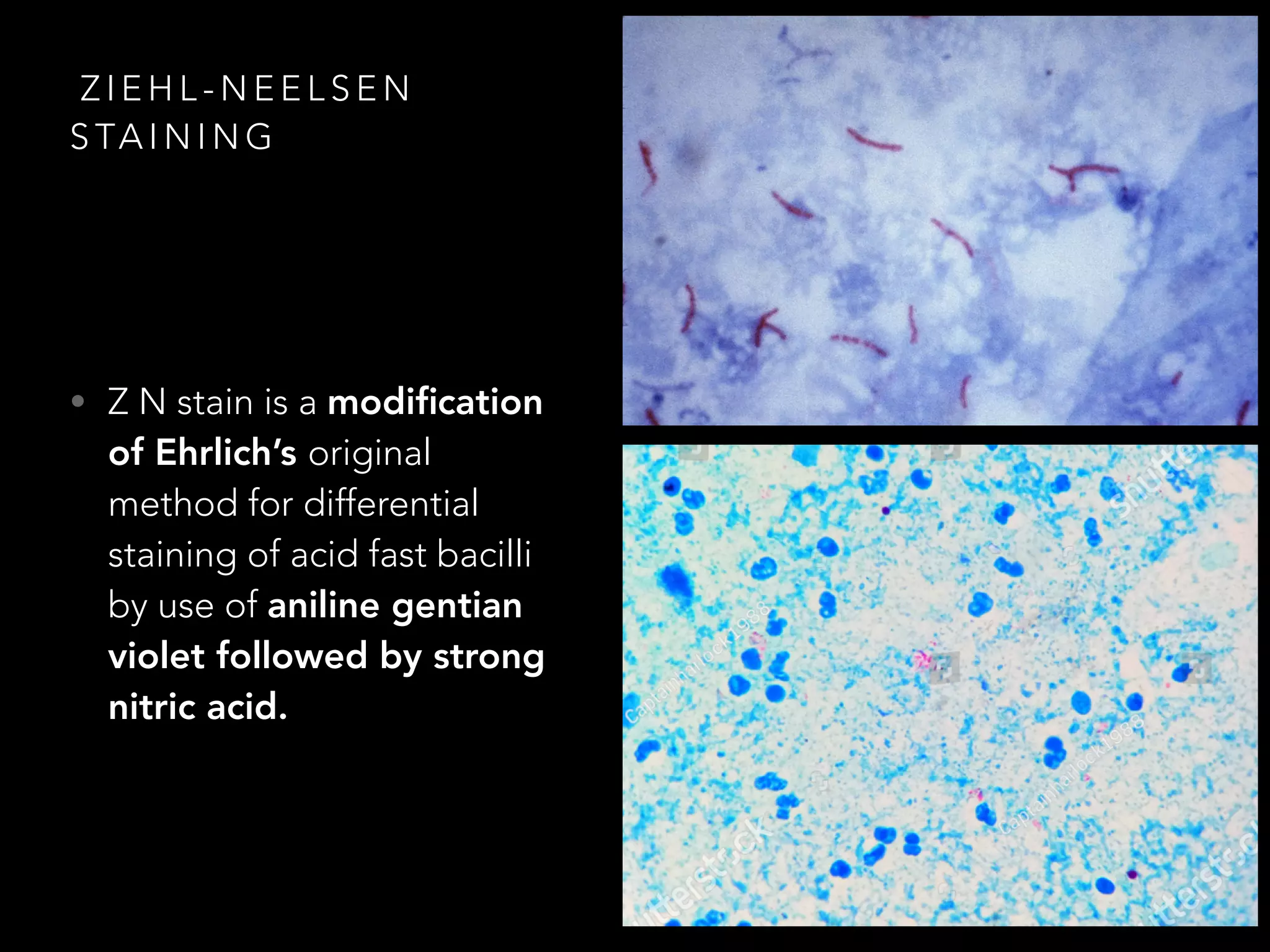 Ziehl neelsen staining | PDF