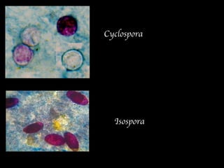 Ziehl neelsen staining | PDF