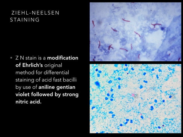 Ziehl neelsen staining | PDF