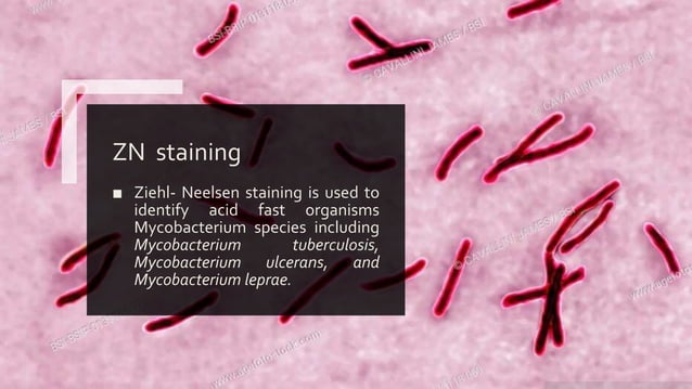 ZN staining | PPTX | Chemistry | Science