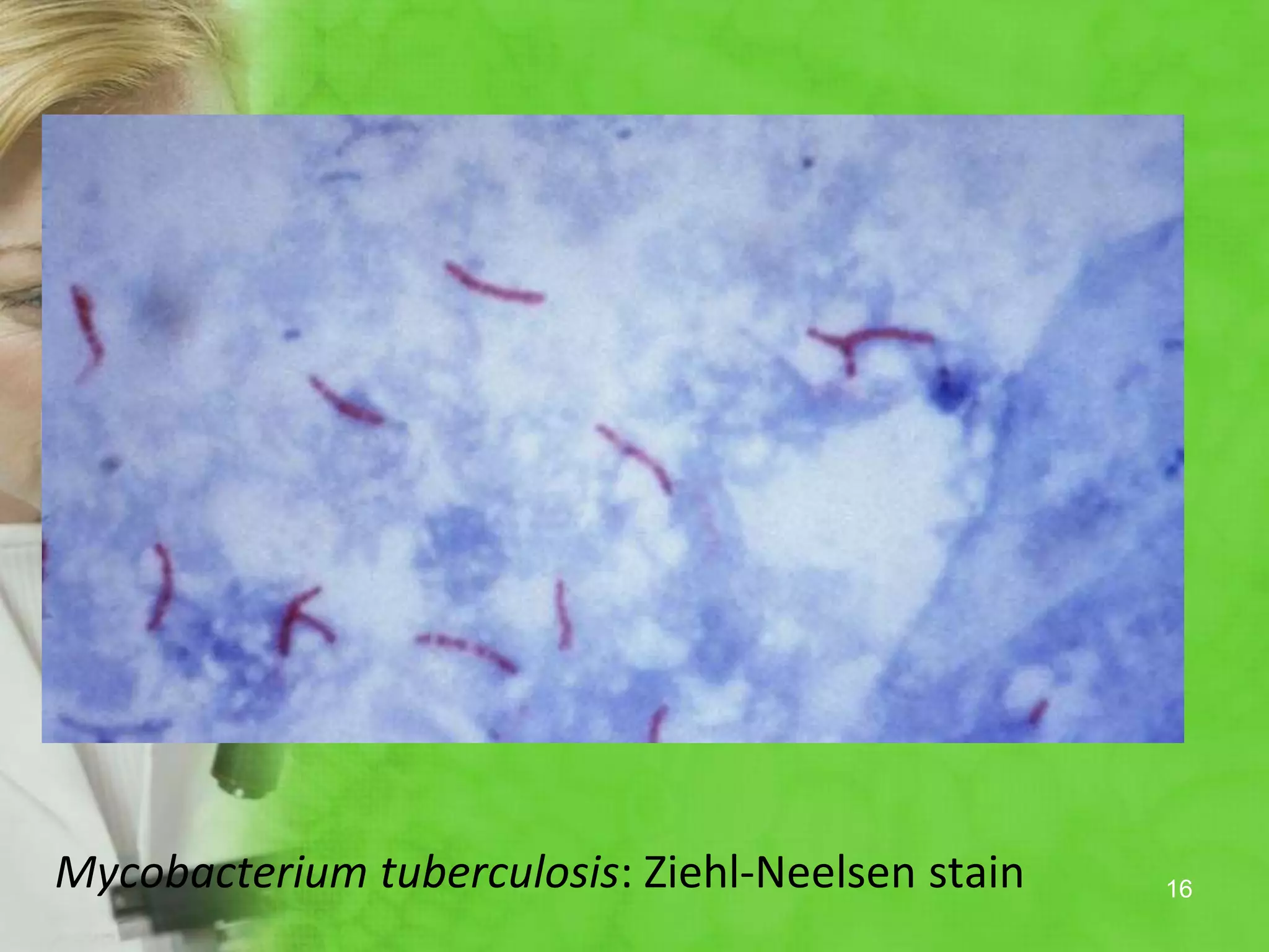 Ziehl–Neelsen staining for medical students | PPTX
