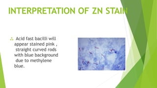 Zn Staining , morphology and different types. | PPTX