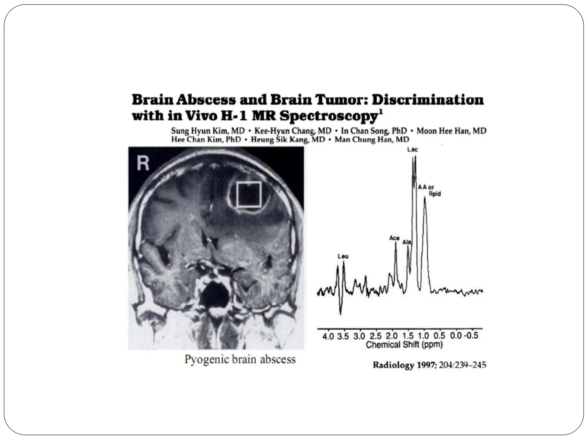 Brain abscess and it course of treatment | PDF
