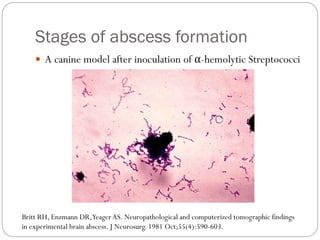 Brain abscess and it course of treatment | PDF