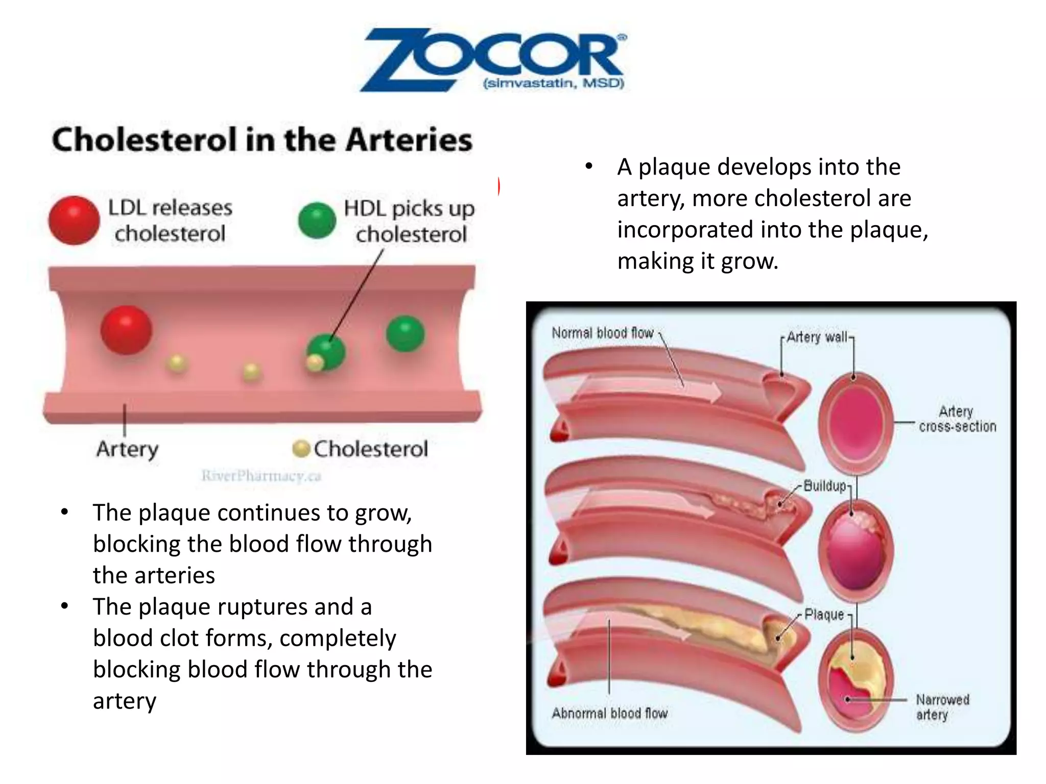 Zocor product monograph | PPTX | Heart and Cardiovascular Diseases ...