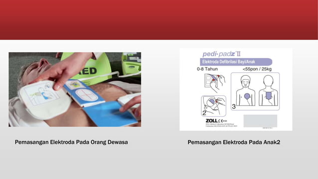 ZOLL AED Plus® PRESENTATION WITH II.pptx