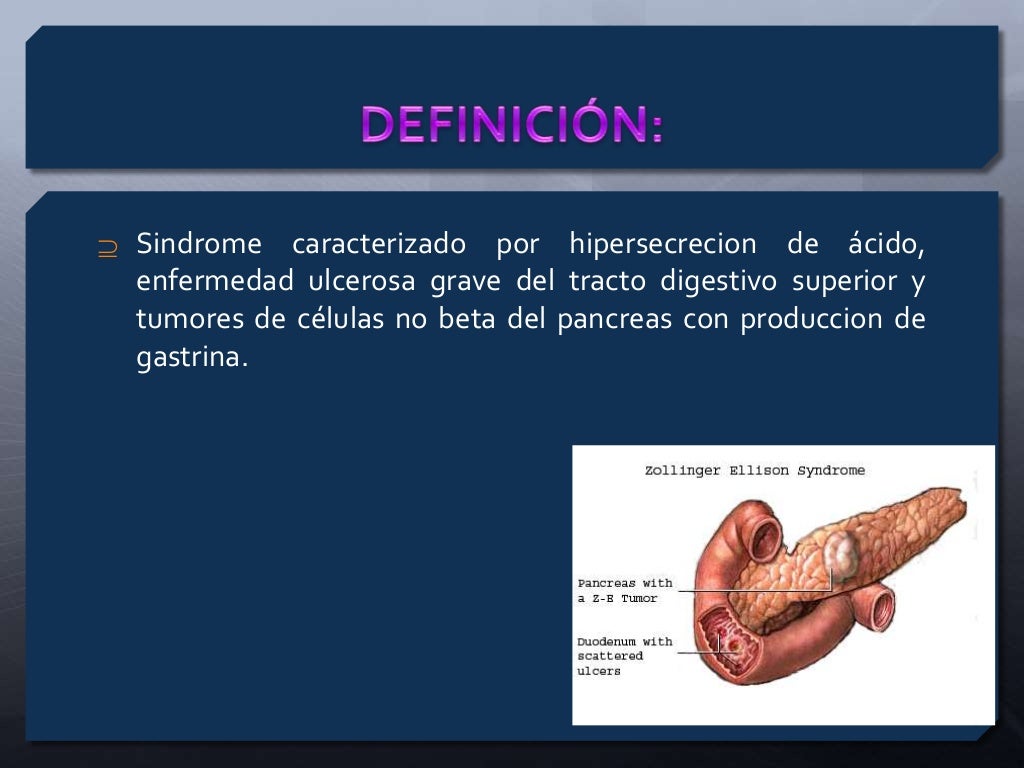 Zollingerellison Syndrome Gastrin Gastrinoma Labpedianet