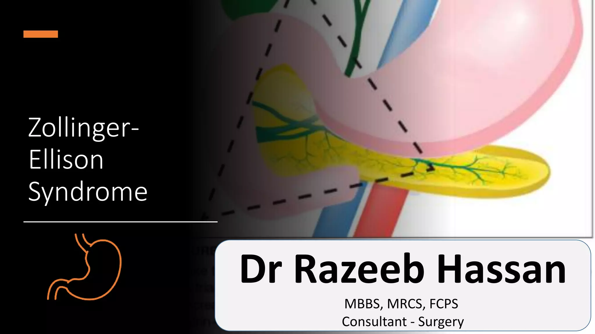 Zollinger ellison syndrome | PPTX | Endocrine and Metabolic Diseases ...