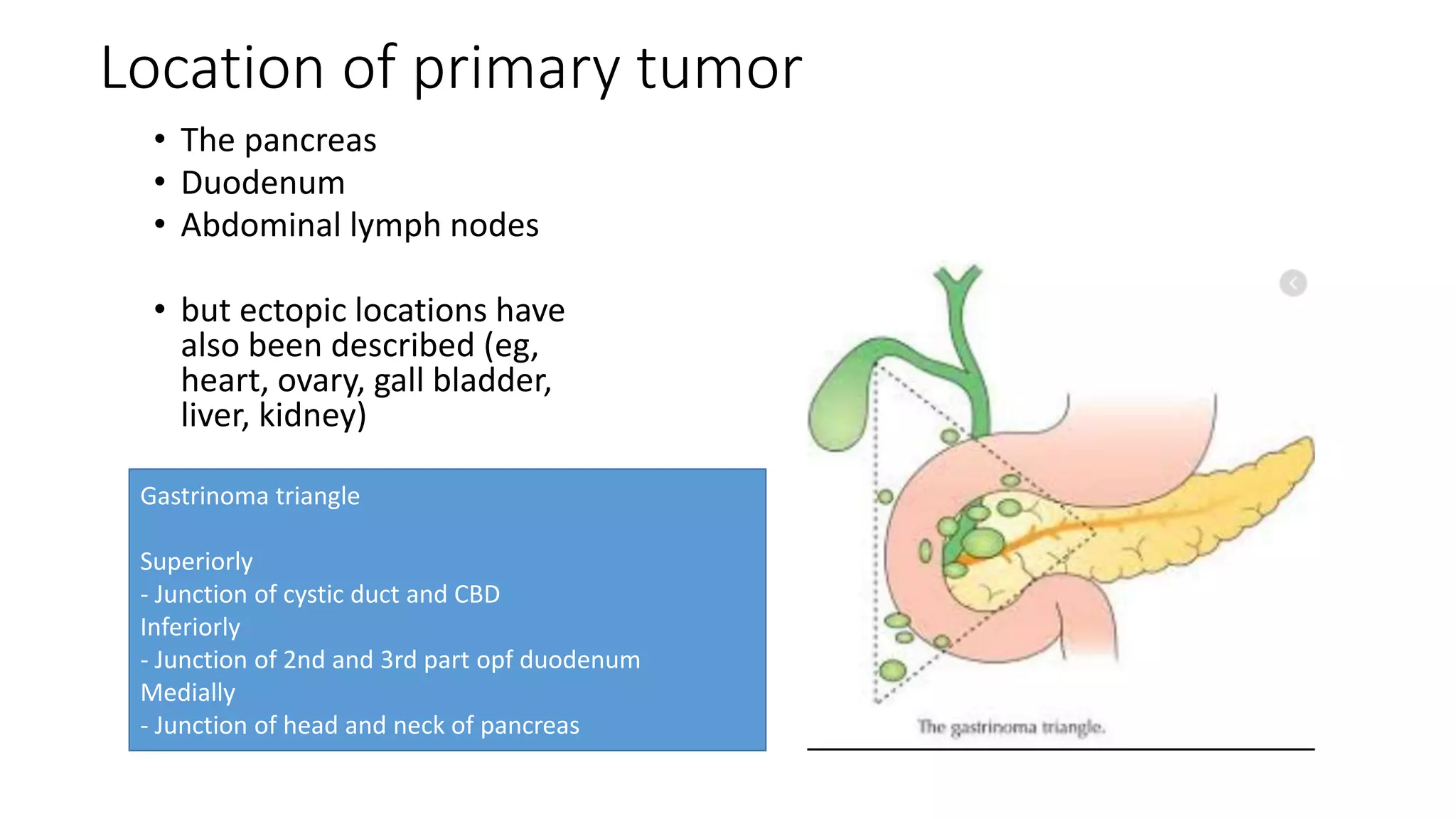 Zollinger ellison syndrome | PPTX